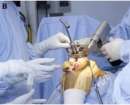 A-B-Illustration-of-total-knee-replacement-procedure-Figure-source ...